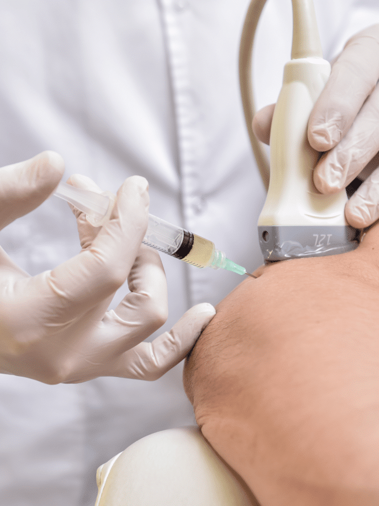 Ultrasound-Guided Injections: Enhancing Precision and Safety in ...
